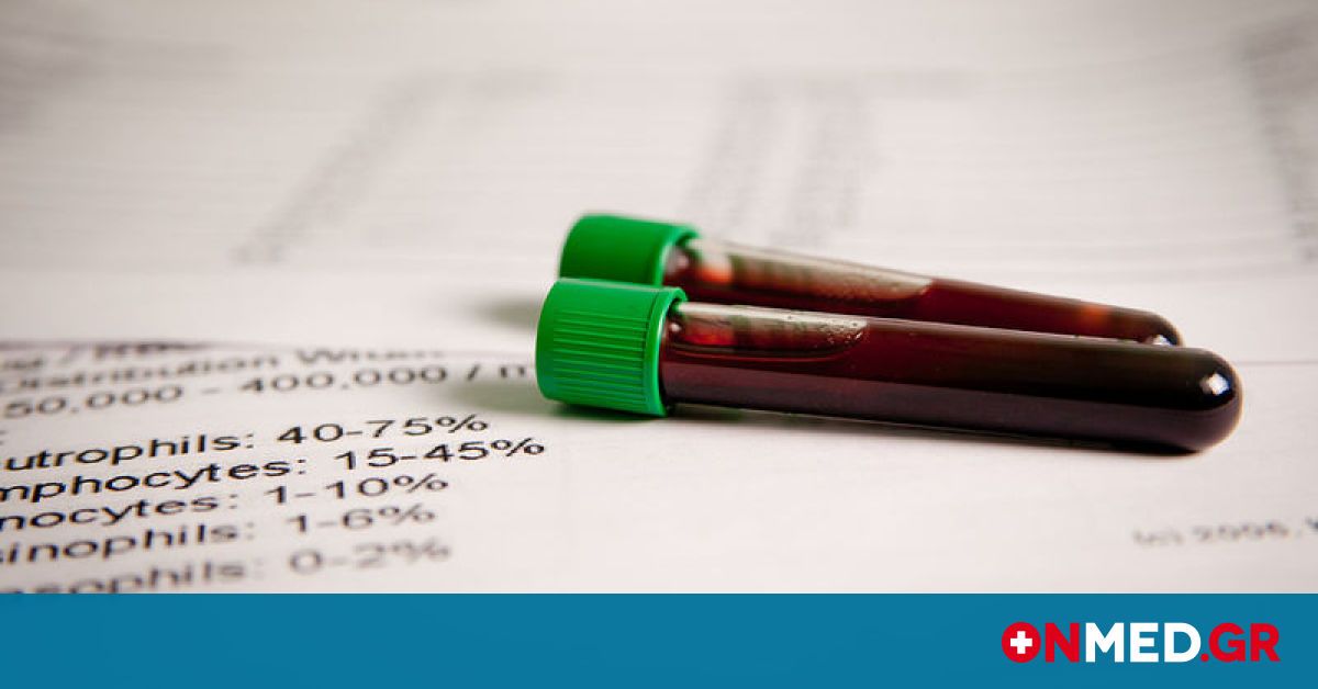 Αιματολογικές εξετάσεις: 5 ερωτήσεις που πρέπει να κάνετε στον γιατρό ...