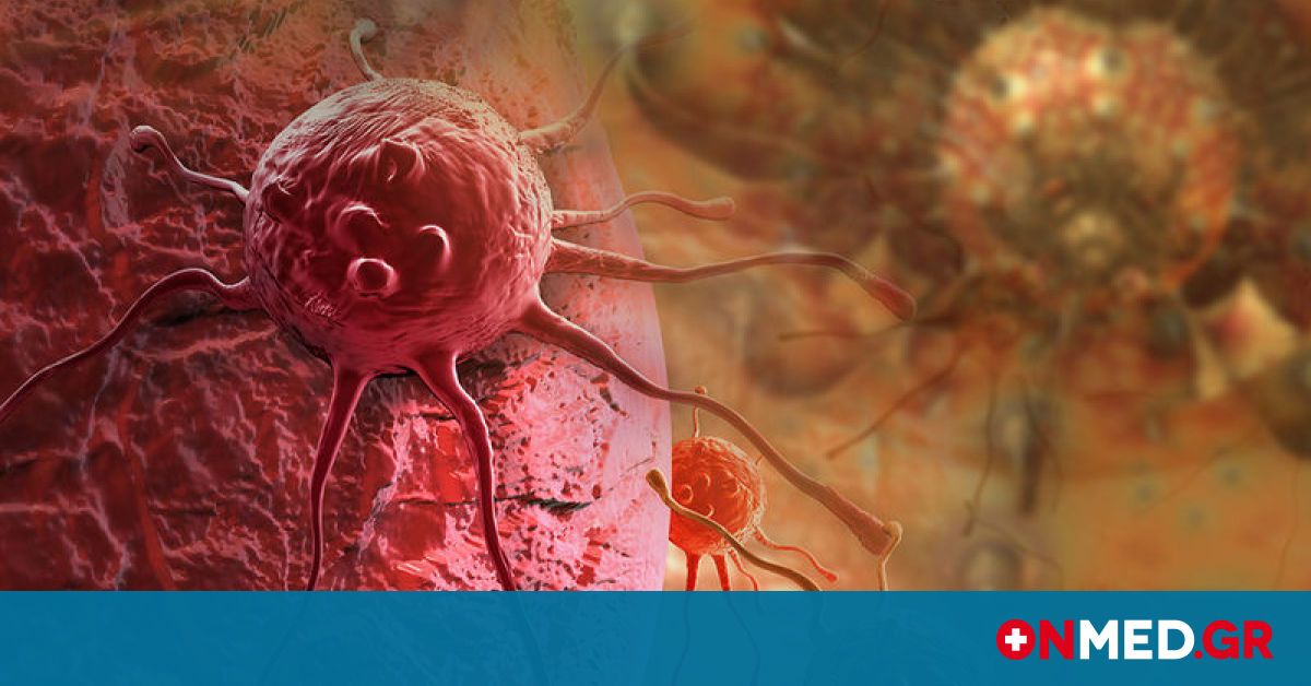 Καρκίνος παχέος εντέρου: Το φρούτο που εξοντώνει τα καρκινικά κύτταρα