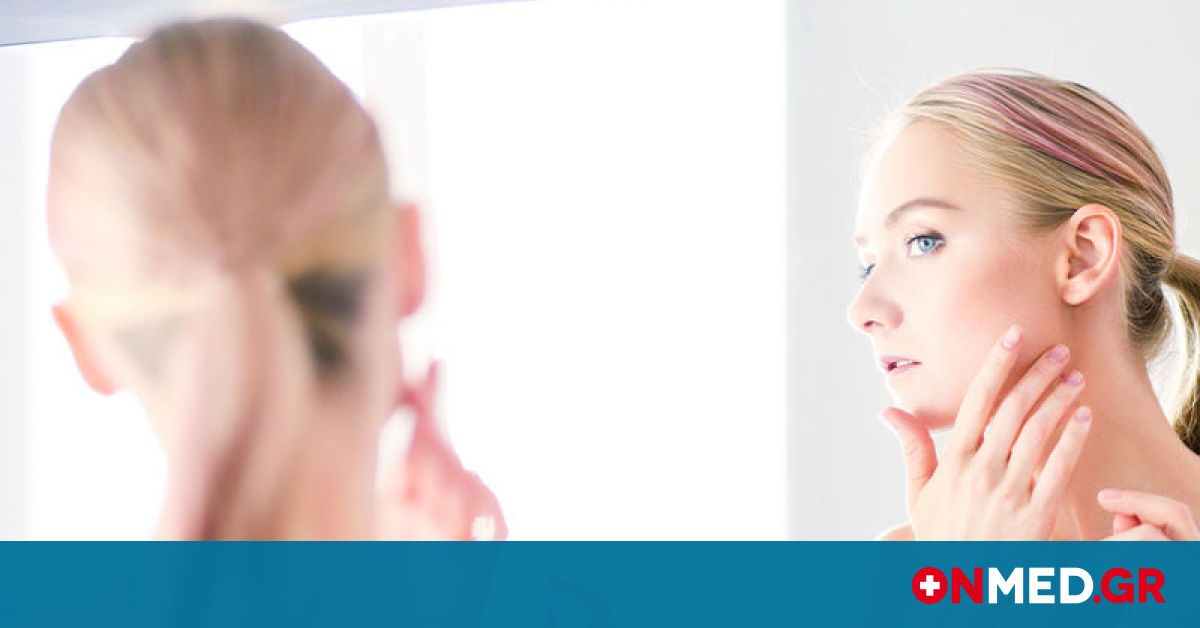 Επτά δερματικές παθήσεις που «μιμούνται» την ακμή (εικόνες)