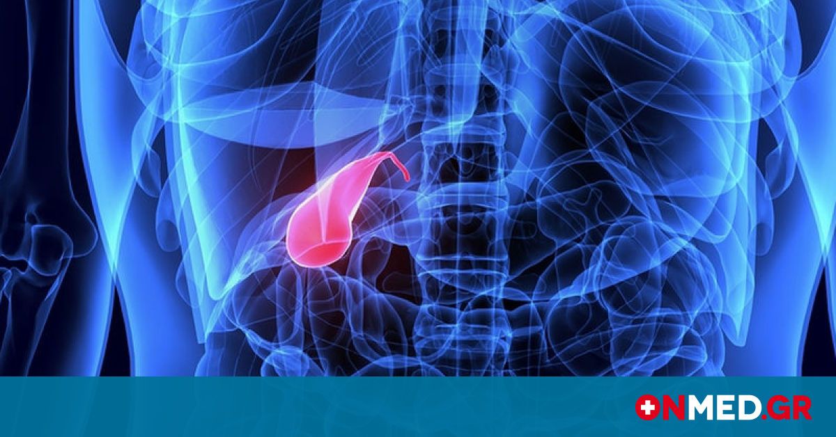 Χολή: Οι 9 καλύτερες τροφές για την υγεία της χοληδόχου κύστης (φωτο)