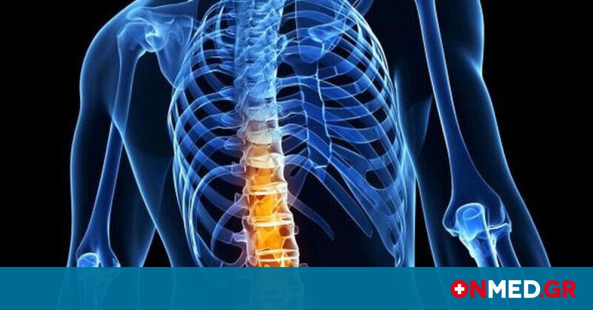 Αγκυλοποιητική σπονδυλοαρθρίτιδα: Συμπτώματα - Διάγνωση - Αντιμετώπιση