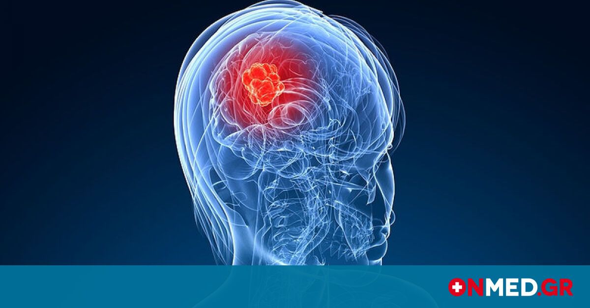 Καρκίνος στο κεφάλι: Κοινά συμπτώματα που δεν πρέπει να αγνοείτε (εικόνες)