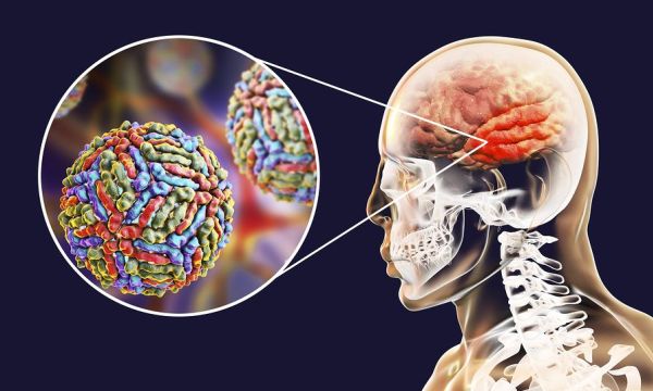 ΕΓΚΕΦΑΛΙΤΙΔΑ