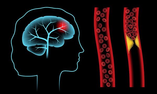 ΑΓΓΕΙΑΚΟ ΕΓΚΕΦΑΛΙΚΟ ΕΠΕΙΣΟΔΙΟ